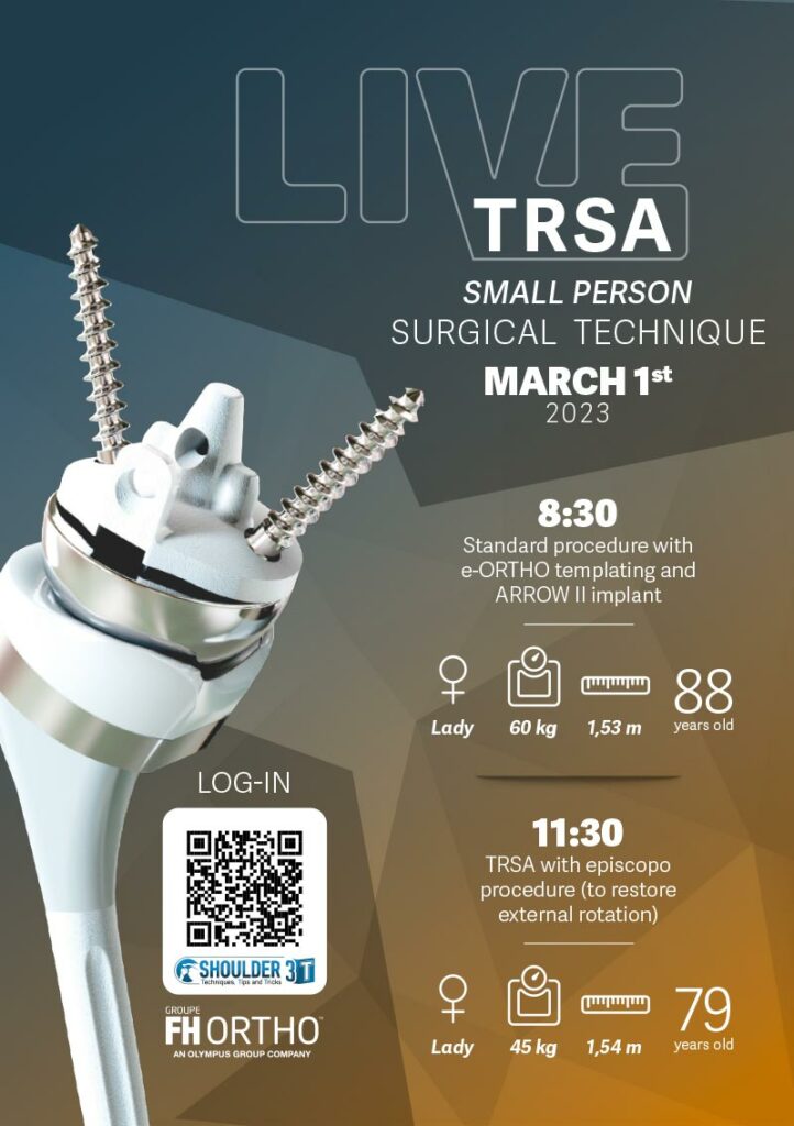 Osteoarthritis Hamada 4B E3 - Small patient 153cm - 65kg - Shoulder 3T